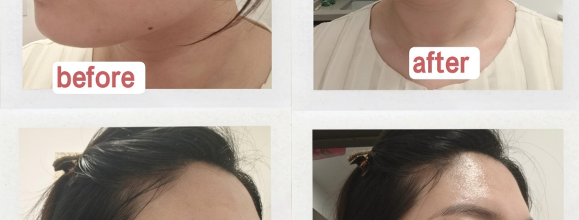 Red Light Therapy Mask: Complete Skincare Guides for Radiant, Youthful ...